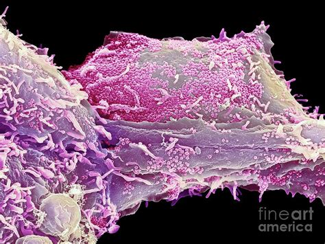 Cell Infected With Herpes Virus Photograph By Science Photo Library