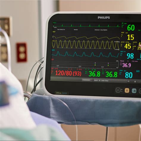 Монитор пациента Philips Efficia Cm150 монитор прикроватный Филипс