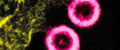 Препарат ленакапавир показал эффективность 96 в профилактике ВИЧ