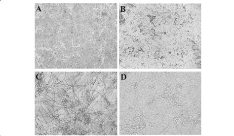 Effects Of L Casei Shirota On The Early Biofilm Formation And Hyphal