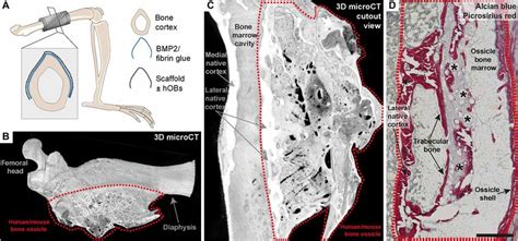 Humanized Bone Ossicle Forms Around The Mouse Femur After Implantation