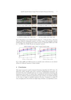 QuaSI Quantile Sparse Image Prior For Spatio Temporal Denoising Of