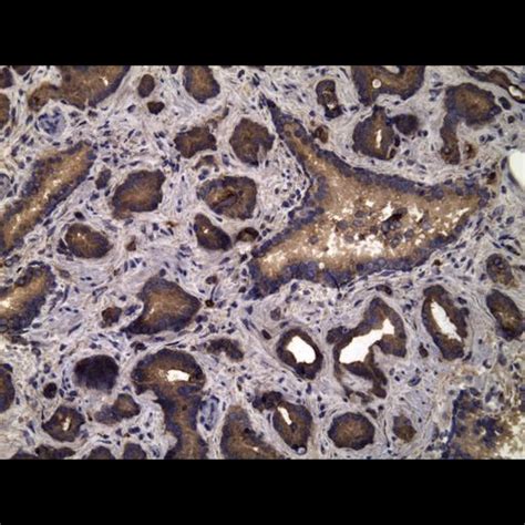 Cil33670 Homo Sapiens Endocrine Paracrine Cell Of Prostate Gland