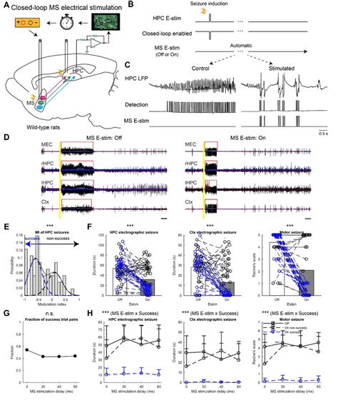 Closed Loop Seizure Rhythm Driven Ms E Stim Terminates Seizures Of