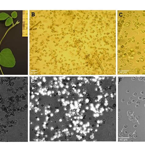 Isolation Of Protoplasts From Trifoliate Leaves Of Soybean Plantlets Download Scientific