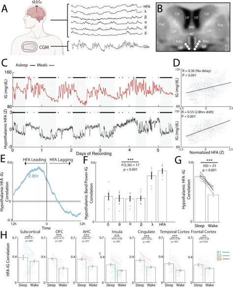 Spectro Spatial Features In Distributed Human Intracranial Activity