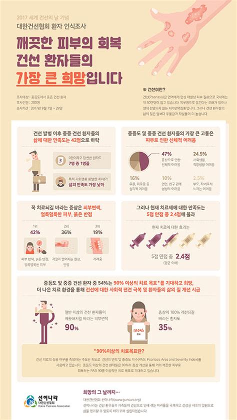 중증 건선 환자 ‘삶 만족도 100점 만점에 42점 당신의 건강가이드 헬스조선