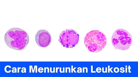 Leukosit Tinggi Memahami Penyebab Gejala Dan Pengobatannya 2025