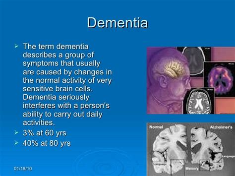 Forgetfulness And Old Age