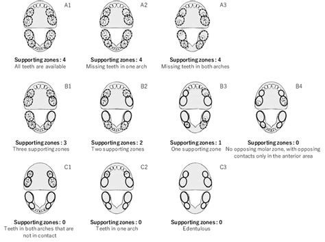 Definition Of Occlusal Support Conditions By The Eichner Classification