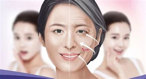 科普线雕能解决哪些问题以及它的适用人群 知乎