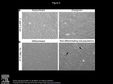 Podocytes In Culture Past Present And Future Ppt Download