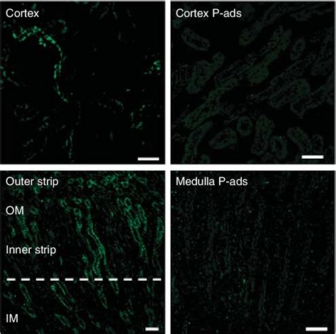 Immunofluorescence Detection Of Subtype 2 Of Download Scientific Diagram