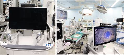 手術支援ロボット「 Hugo Ras System 」導入しました！ 新松戸中央総合病院
