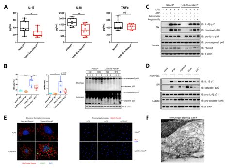 浙大基础医学院王迪组揭示hdac3介导线粒体驱动的il 1β依赖性炎症机制调控