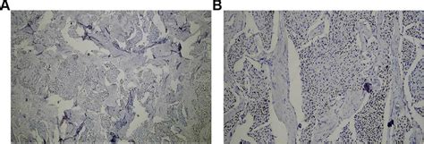 A And B Immunostaining For Progesterone Shows A Nuclear Pattern Of