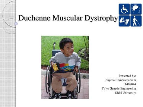 Ppt Duchenne Muscular Dystrophy Powerpoint Presentation Free