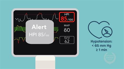 Hypotension Prediction Algorithm Doesnt Reduce Intraoperative