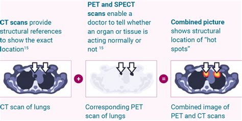 Nuclear Medicine Imaging Page