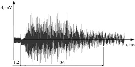 An Example Of Recording A Vibroacoustic Signal After The Pulse 12 Ms Download Scientific