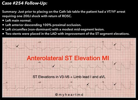 Sush Prusty Md Er Physician Good Morning Everyone And Welcome To This Weeks Case Last