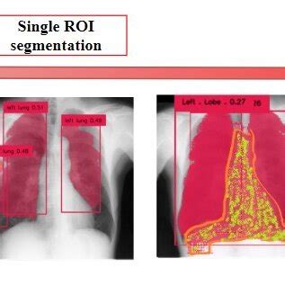 Grounding DINO Results When Prompted With The Anatomical Text Prompts Download Scientific