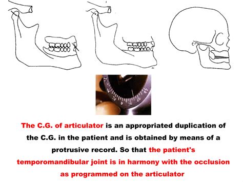 3 Factors Affecting Balanced Occlusion Final Ppt