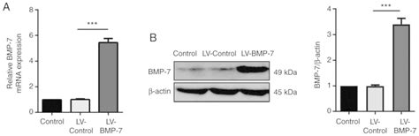 Overexpression of BMP7 reverses TGFβ1induced epithelialmesenchymal transition by attenuating