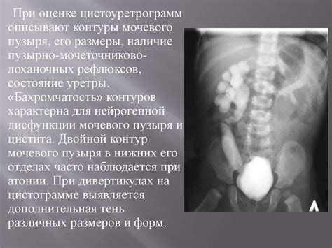 Рентгенологические методы исследования заболеваний почек и мочевыводящих путей в педиатрии