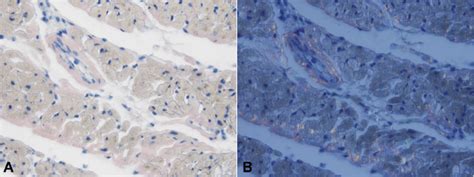 Special Histological Staining A Congo Red With B Polarising