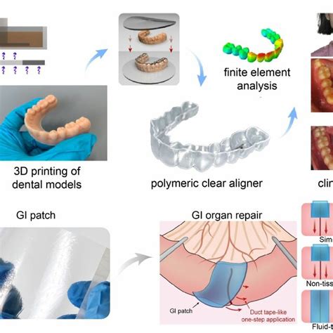 Some Polymer Based Biomaterials With Potential Of Clinical Translation Download Scientific