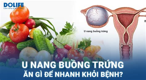 U Nang Buồng Trứng Kiêng Ăn Gì Tìm Hiểu Những Thực Phẩm Cần Tránh