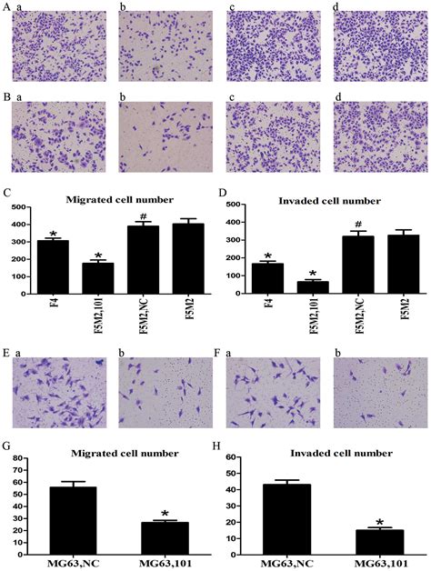 Microrna 101 Inhibits The Metastasis Of Osteosarcoma Cells By
