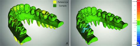 A Representative Stl File Aligned With Reference Stl File For
