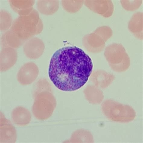 Promyelocytes Identification And Differentiation