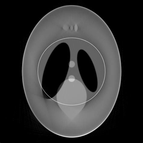 3 Illustration Of The Potential Improvement Using The Adaptive Download Scientific Diagram