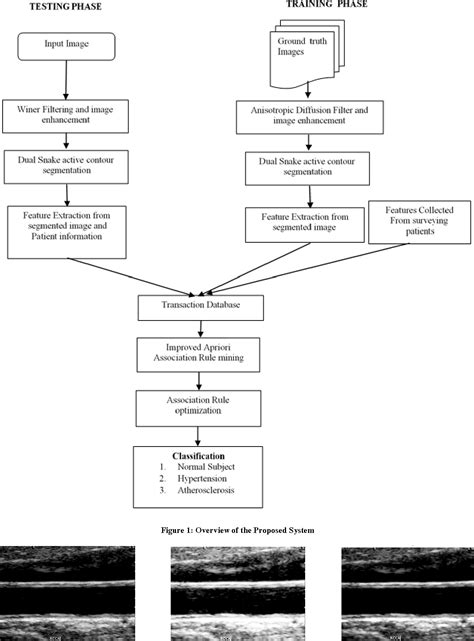 Figure 1 From Medical Decision Support System Of Common Carotid Artery Using Image Mining And