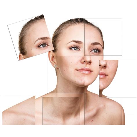 Skincare Demodex Mite Treatment For Demodicosis Itchy Acne