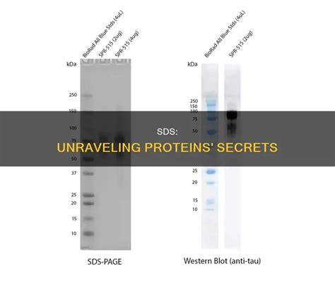 Sds Unraveling Proteins Secrets Medshun