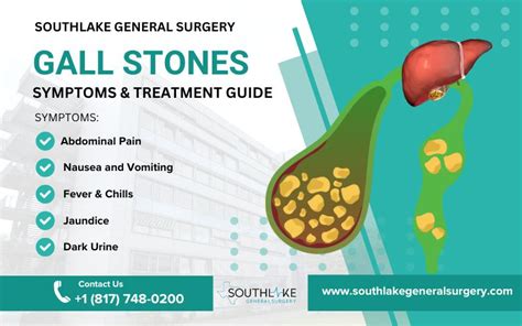 Gall Stones Treatment Essential Guide Southlake General Surgery