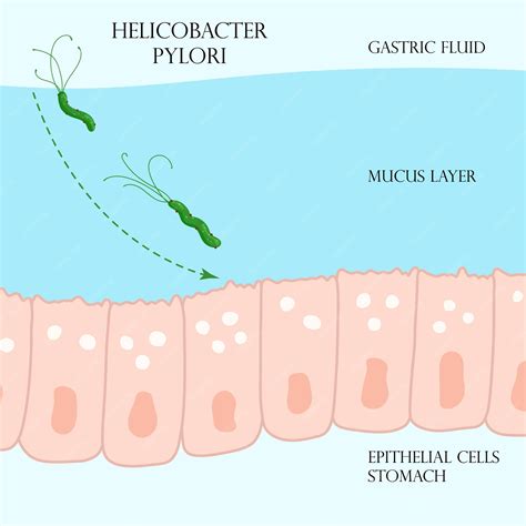 Premium Vector Helicobacter Pylori In Mucosal Layer In Stomach Illustration