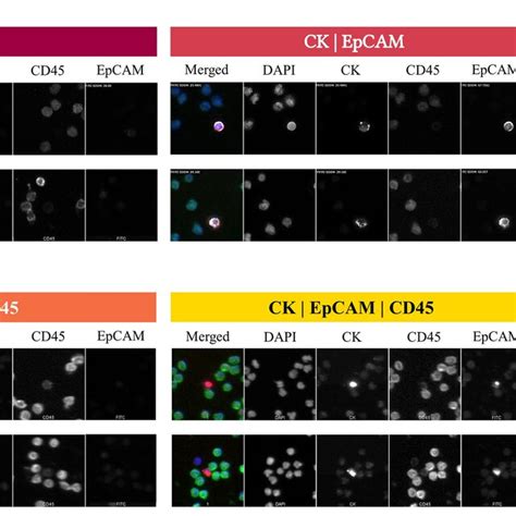 Detected Cells From Um 001 Using The Epcam Assay A Representative