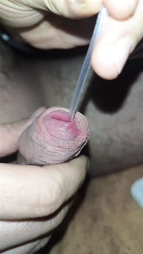 Ureal挿入 私は夫にカテーテルを入れています、それは彼を傷つけます Xhamster