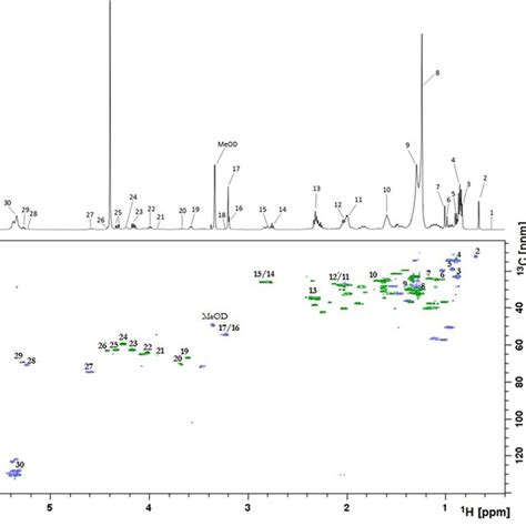Upper Panel A Representative 1 H Nmr Spectrum Of Serum From Obese