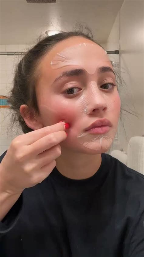 Unlocking The Mystery The Battle Against Stubborn Pimples And