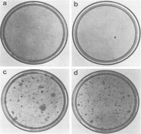 Focus Formation In Nih 3t3 Cells Transfected With Cdna Cl 61 Dl 5