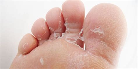 A Photo Diary Of Footner Socks The Genius Gross So Gross Way To