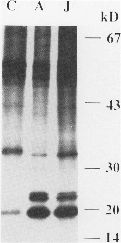 Fluorogram Of 35s Methionine Labeled Oilbody Proteins Isolated From 22