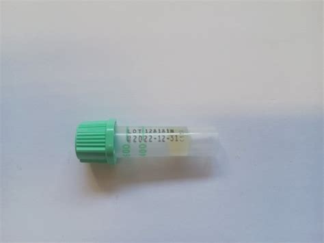 Bilirubin Conjugated Rcht Pathology