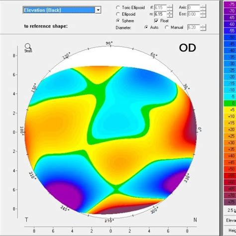 Individual Sagittal Map Download Scientific Diagram